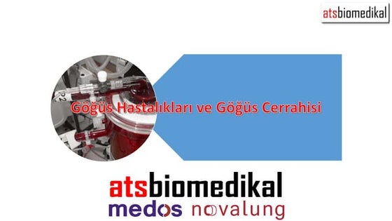 Medos ats biomedikal ecmo ecls | PPT