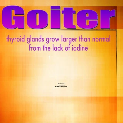 Goiter | PPT
