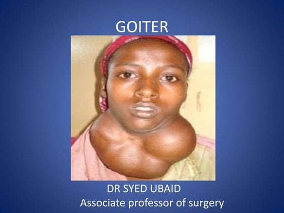 slidesgo-comprehensive-overview-of-thyroid-gland-lesions-nodular-goiter ...