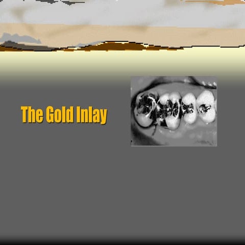 GoldInlay preparation in fixed prothesy dentistry | PDF