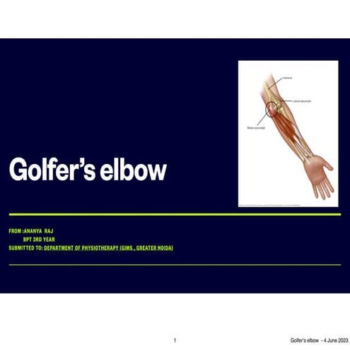 Golfer’s elbow with its rehabilitation and management | PDF
