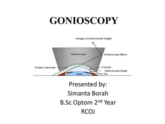 Schematic & Reduced Eye.pptx