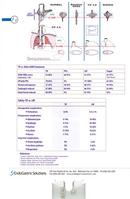 Nephrectomy | PPT | Surgery | Medical Health