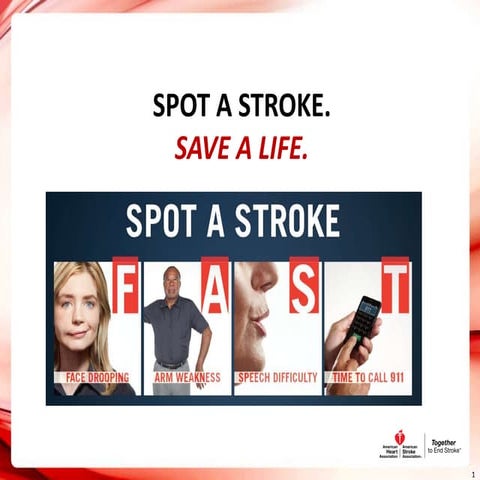 FAST Stroke Presentation | PPTX