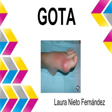 Gota enfermedad en las articulaciones | ODP