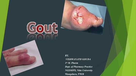 Pathophysiology of Gout | PPT