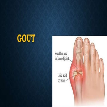 Gout // WHAT IS GOUT | PPT