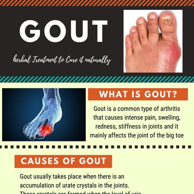 Gout - Causes, Symptoms and Herbal Treatment | PDF