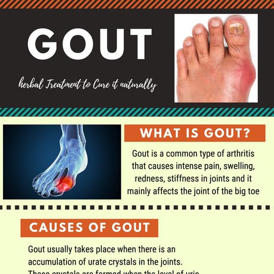 Gout Foot | PPT