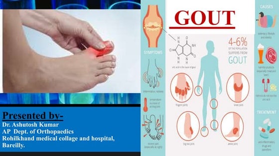 Gout | PPTX