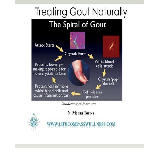 Treating Gout | PPT