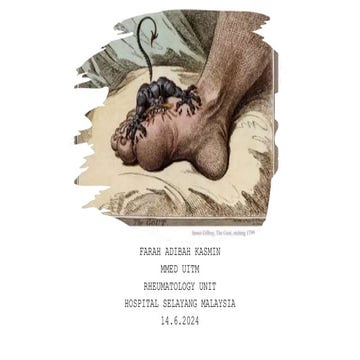 The Painful Gout - A Disease of The King | PPT