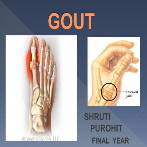 Gout | PPT