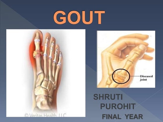 Shoulder | PDF