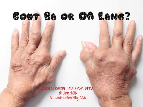 Gout case presentation | PPT