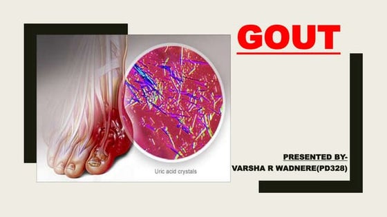 Gout case presentation | PPT