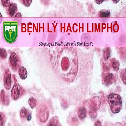 GPB BL HẠCH LIMPHÔ.ppt.pdfl;ànd;ádf;sadf;l | PDF