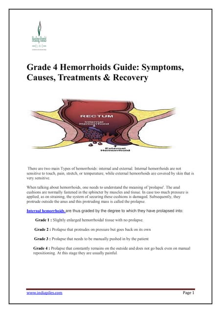 Some facts about internal hemorrhoids | PPTX | Digestive Disorders ...