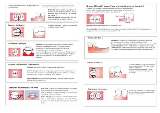 Arco Tipo I e Tipo II de Baume - Resumo Concurso Público de Odontologia.pdf