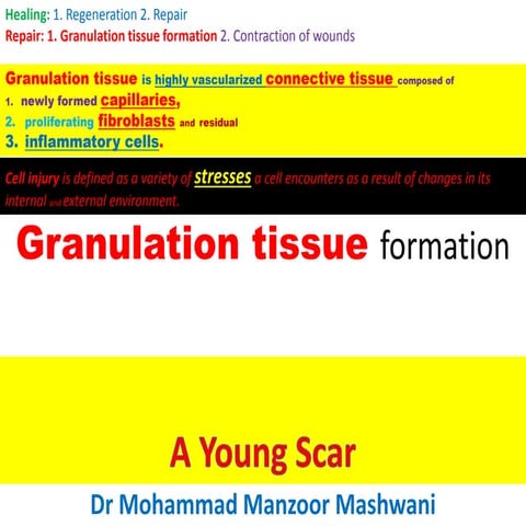 Granulation Tissue Wound