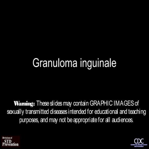 Granuloma inguinale | PPT