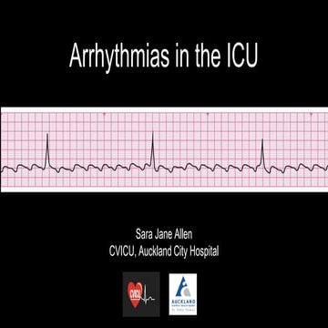 Arrhythmias in the ICU: An Intensivist’s approach by Dr Sara Allen | PPTX