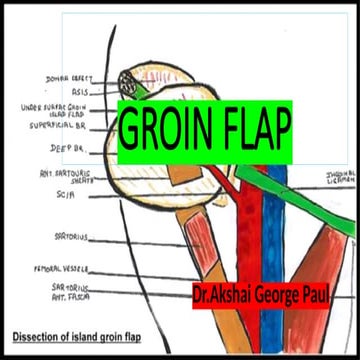 Groin Flap-(Superficial circumflex iliac artery) Dr.AGP.pptx