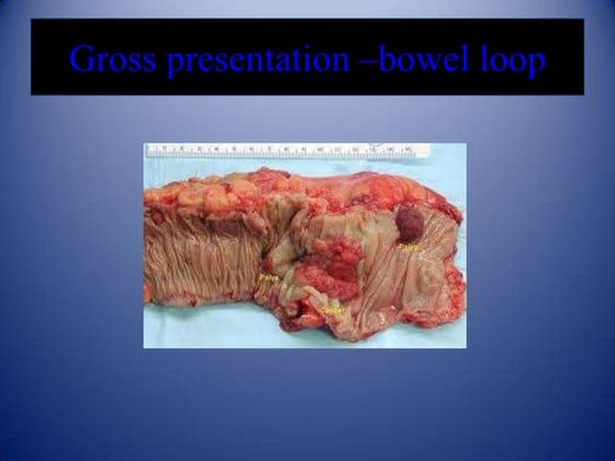 grossing of Colorectal specimens | PPTX