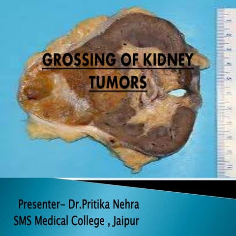 Prostate grossing and reporting | PPTX