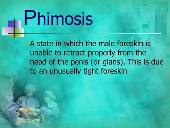 phimosis final.pptx