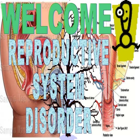 Group 5 Reproductive Disorder2 | PPT