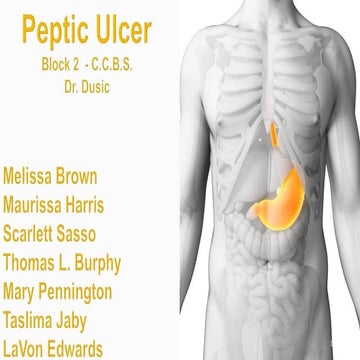 Peptic Ulcer Saint James School of Medicine | PPT