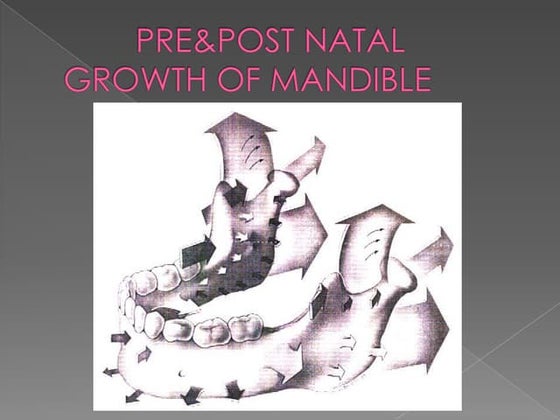 Prenatal and postnatal growth of mandible | PPTX | Bone and Joint ...