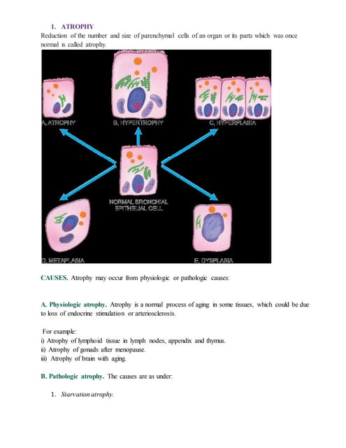 Cellular or Cell adaptation !! pathology - Harsh mohan !! cell injury ...