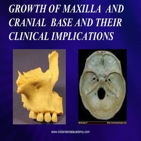 Growth of maxilla /certified fixed orthodontic courses by Indian dental ...