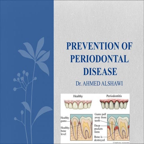 5 prevention of periodontal disease | PPT