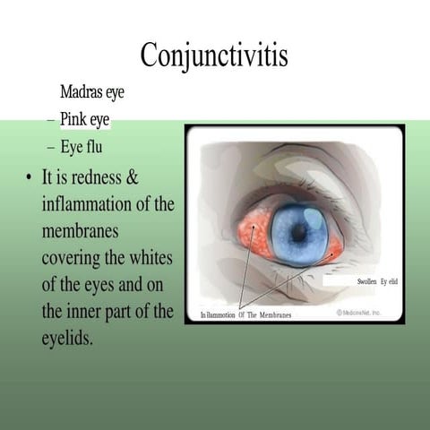 Conjuctiva bacterial eye type of conjunctivitis .pptx