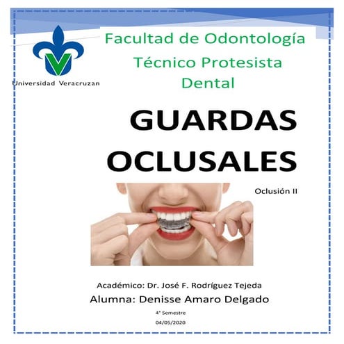 Guardas oclusales denisse amaro delgado | PDF