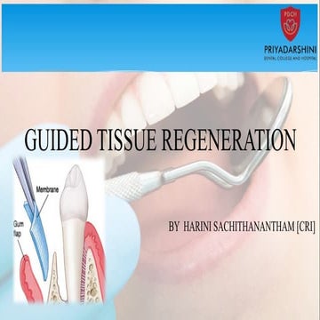 Guided tissue regeneration in perio.pptx