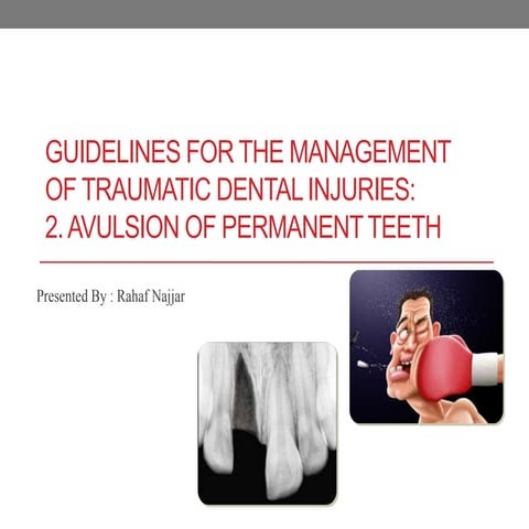 Guidelines for the management of avulsion | PPTX