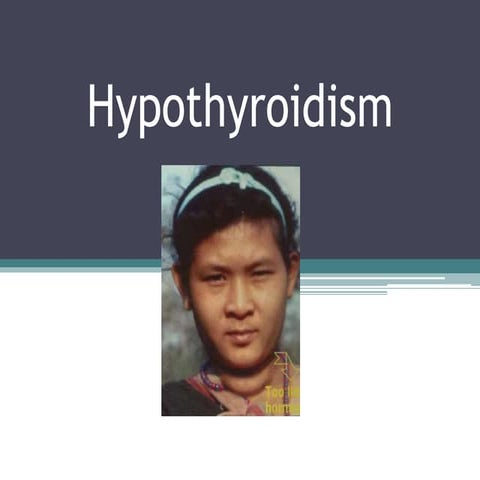 Guidelines for the Treatment of Hypothyroidism.pptx