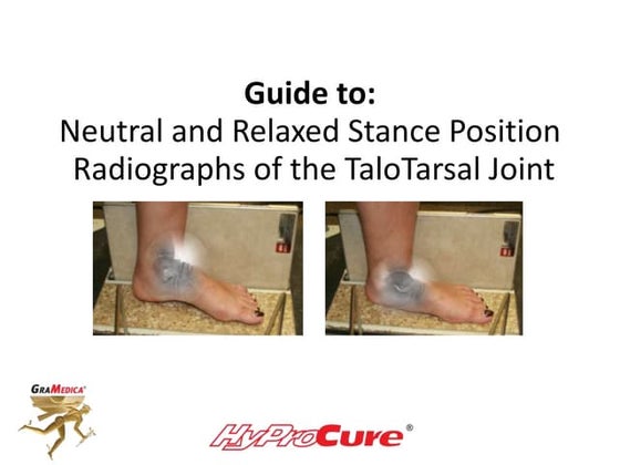 Foot X-ray by Akash Das | PPT