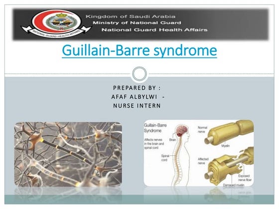 Guillain Barre Syndrome | PPT
