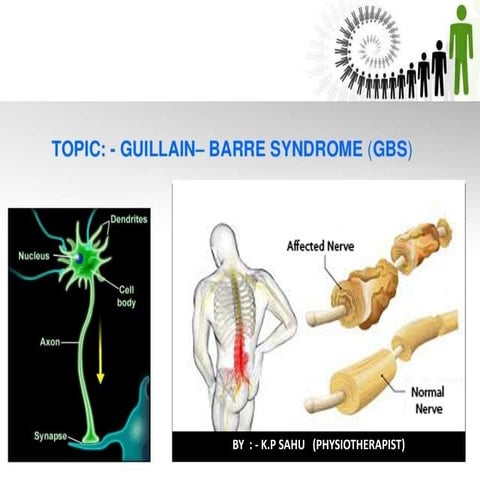 guillainbarr-syndrome-gbs-.pptx