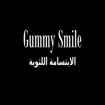 Gummy Smile causes types clasfications treatment options.pptx