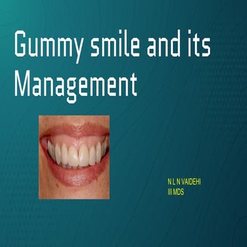 Gummy smile ppt | PPTX