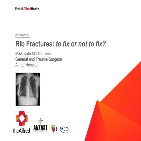 Ribs: To fix or not to fix? | PPTX