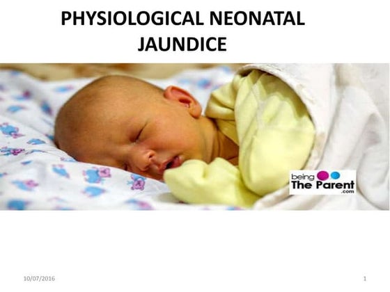 Neonatal jaundice | PPT
