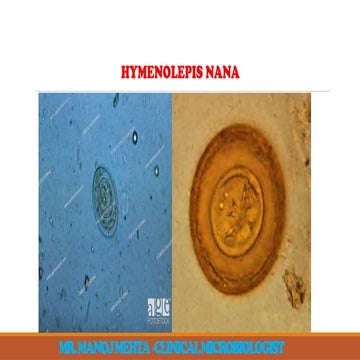 H.nana.pptx Manoj Mahato Msc.Clinical micro | PPTX