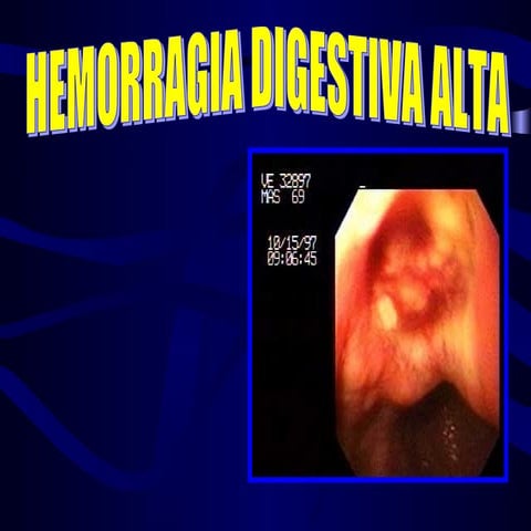 Escala forrest hemorragia digestiva | PDF